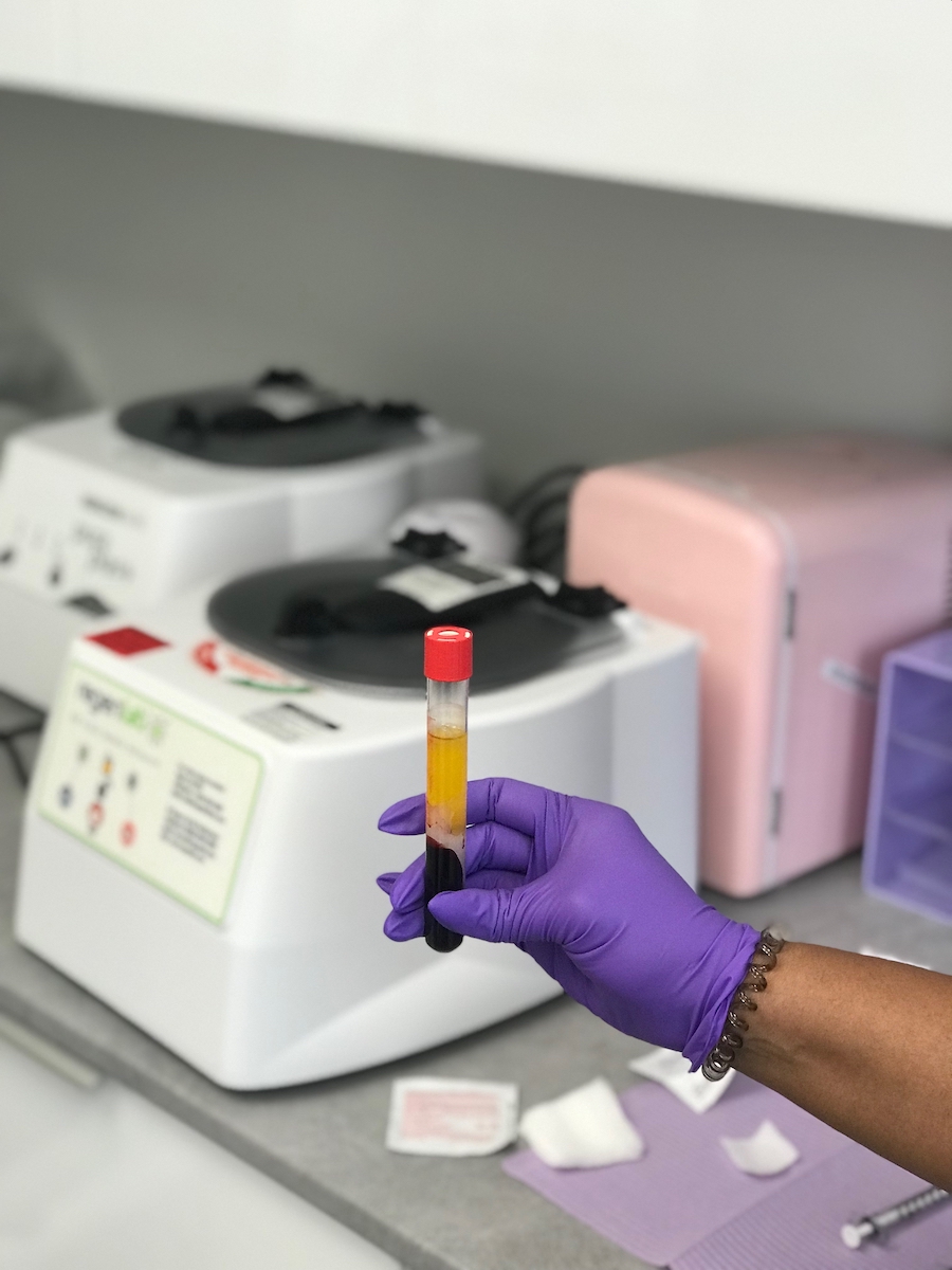 Chronic Pain? PRP Could Be What You Need - Deez Skin Rejù & Pain Clinic